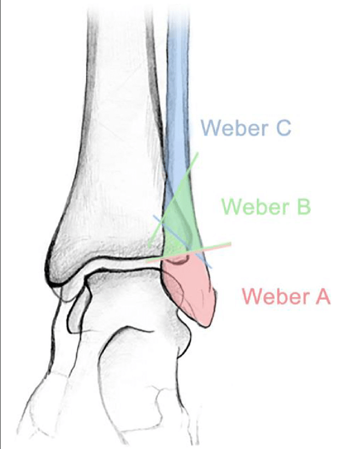 Ankle & Foot Injuries