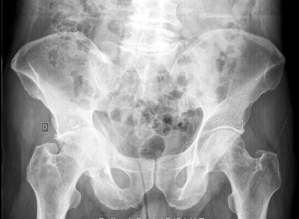 FRCEM Secrets | Structured Notes & Practice Questions for FRCEM