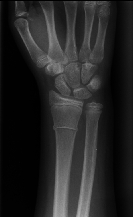 FRCEM Secrets | Structured Notes & Practice Questions for FRCEM