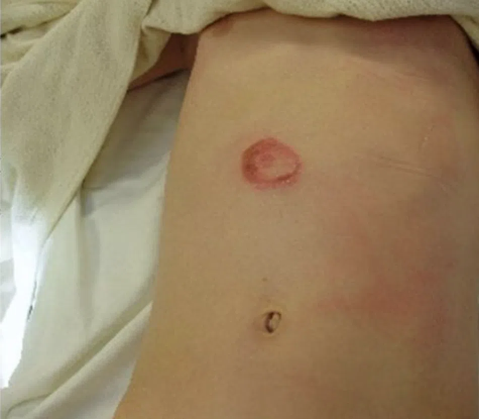 Abdominal Trauma - FRCEM Secrets