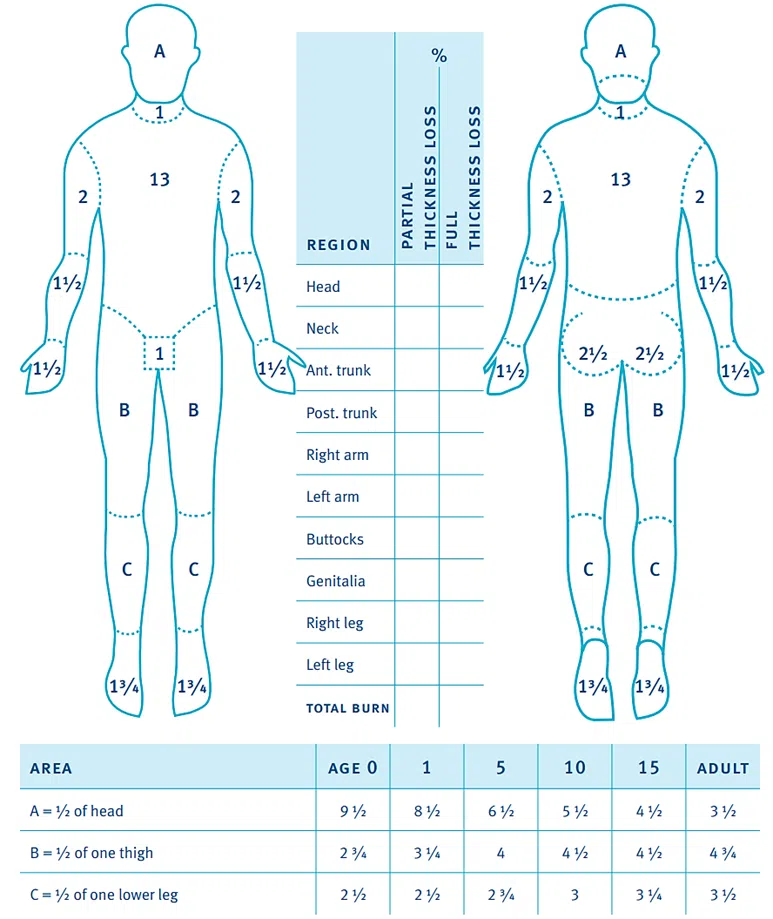 Burn injury - FRCEM Secrets