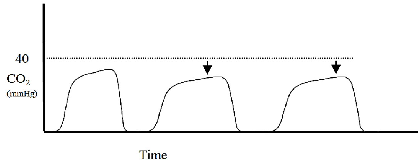 FRCEM Secrets | Structured Notes & Practice Questions for FRCEM