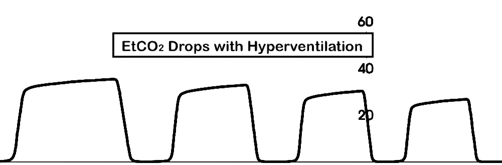 Capnography