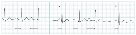 FRCEM Secrets | Structured Notes & Practice Questions for FRCEM