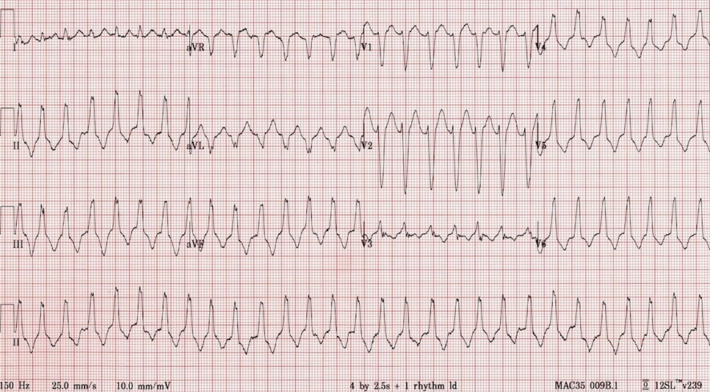 FRCEM Secrets | Structured Notes & Practice Questions for FRCEM