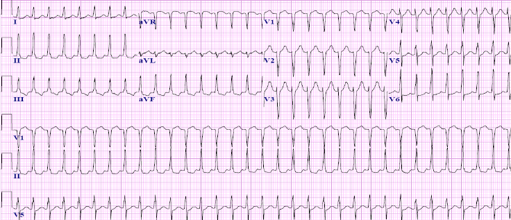 FRCEM Secrets | Structured Notes & Practice Questions for FRCEM