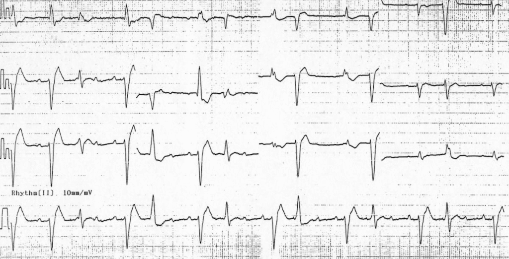 FRCEM Secrets | Structured Notes & Practice Questions for FRCEM