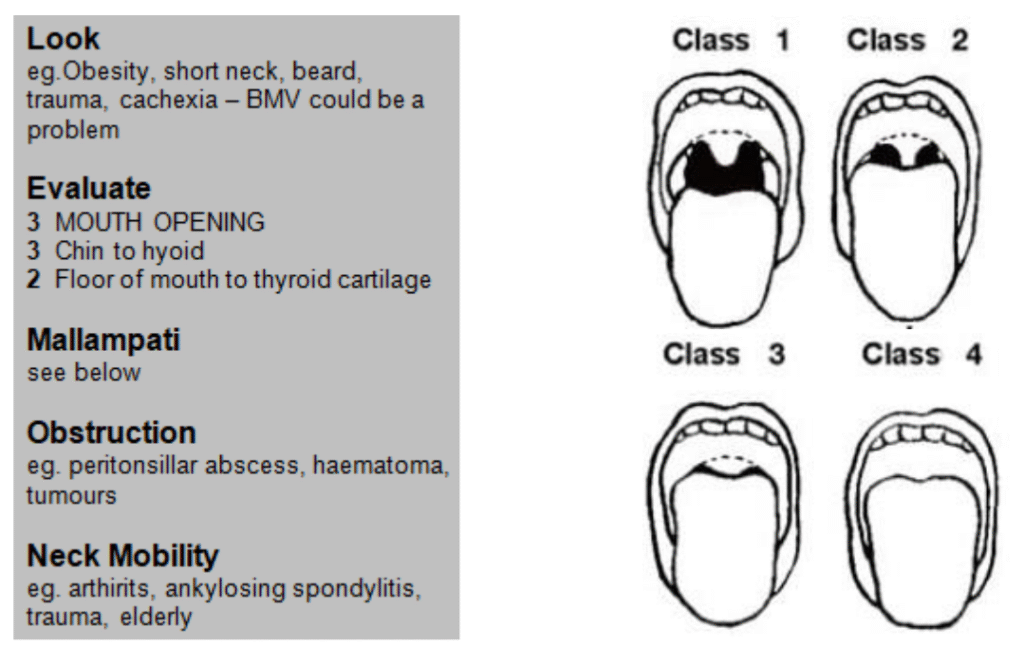 FRCEM Secrets | Structured Notes & Practice Questions for FRCEM