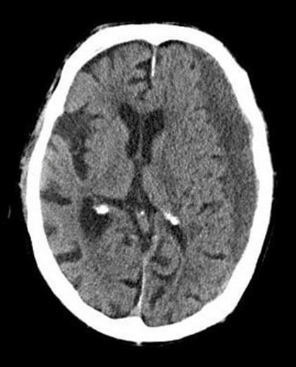 Bank of SBA questions