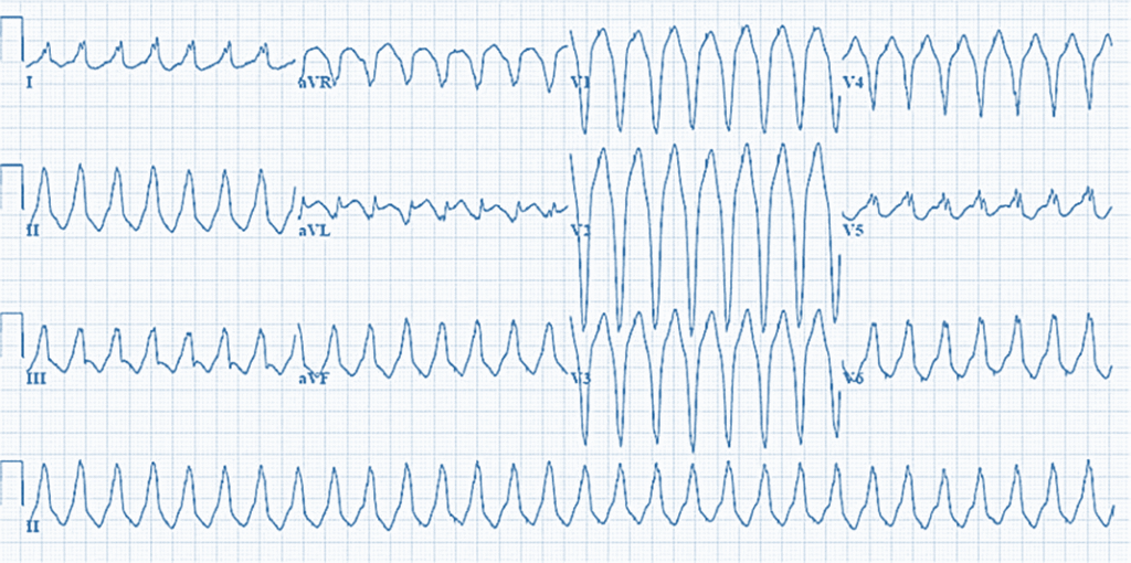 Mock Test: Take the FRCEM Exam Challenge with 25 SBA Questions