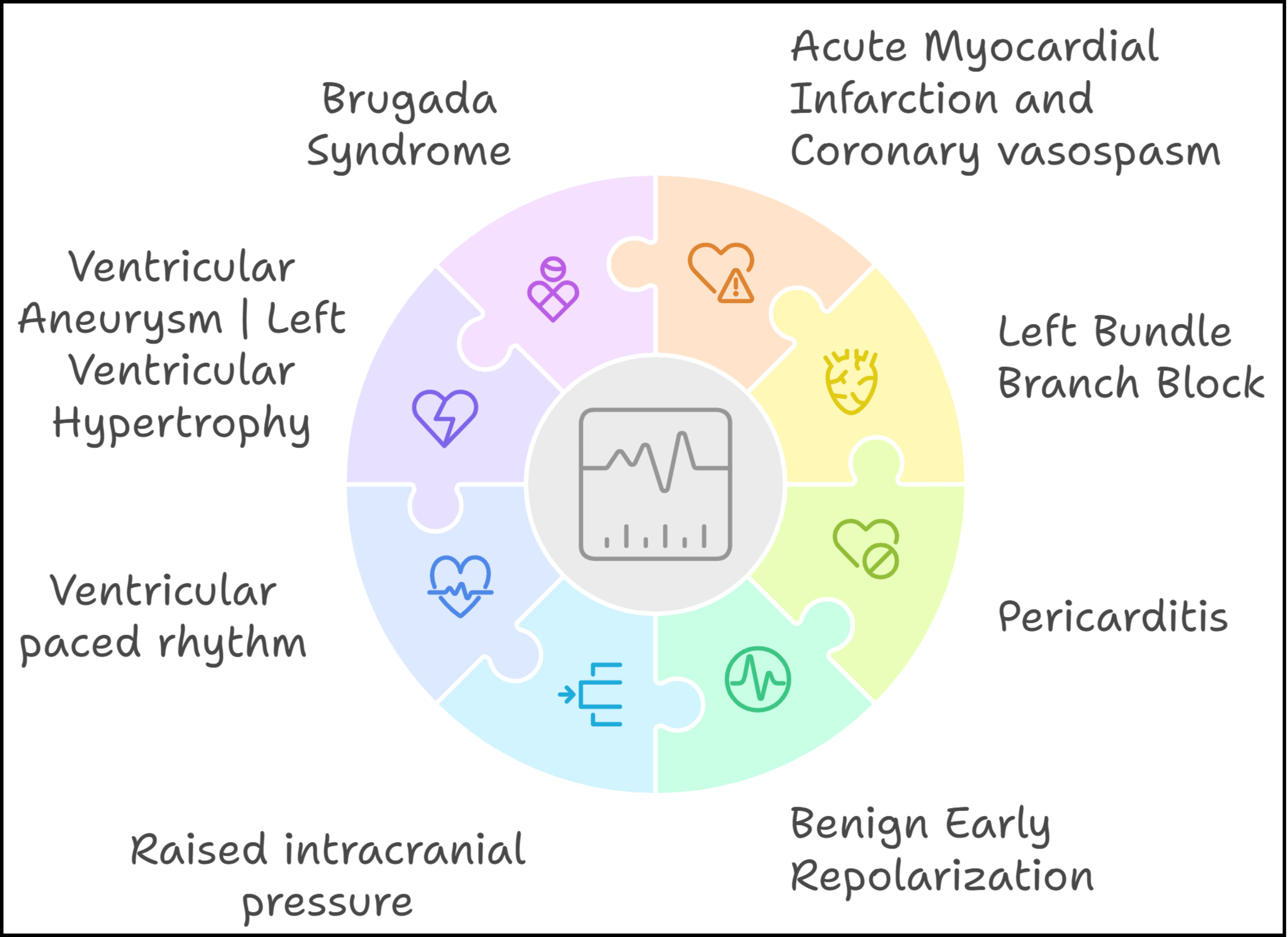 STEMI Mimics ECGs